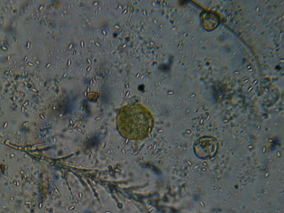Sick Bees - Part 13: Simple Microscopy of Nosema for Beekeepers ...