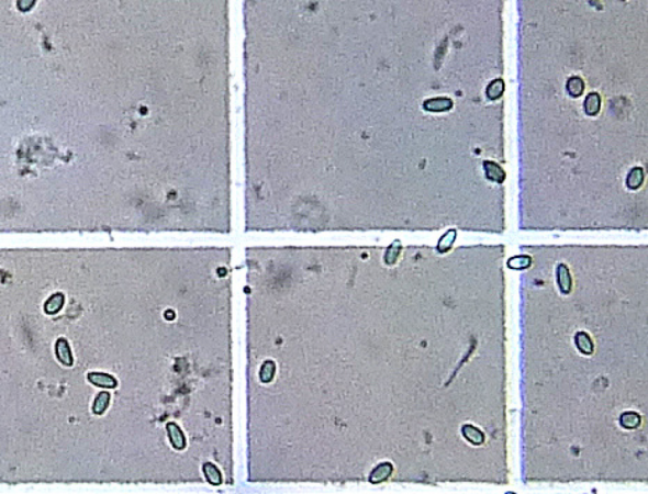Sick Bees - Part 13: Simple Microscopy of Nosema for Beekeepers ...