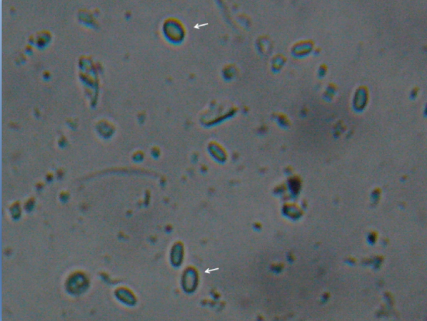 Sick Bees - Part 13: Simple Microscopy of Nosema for Beekeepers ...