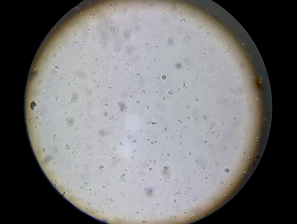 Sick Bees - Part 13: Simple Microscopy of Nosema for Beekeepers ...