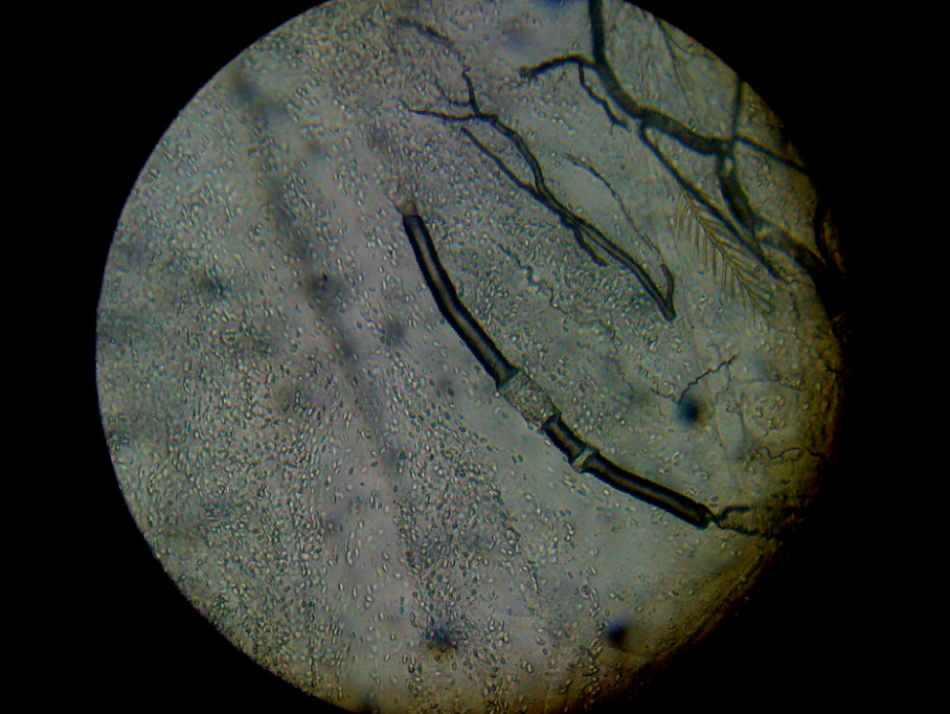 Sick Bees - Part 13: Simple Microscopy of Nosema for Beekeepers ...