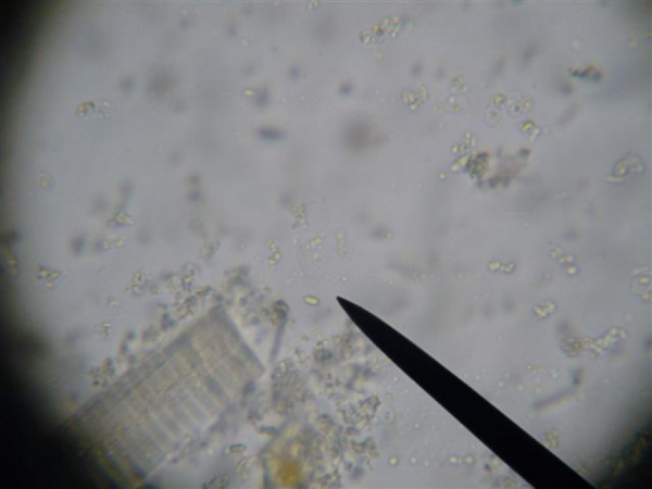 The "Nosema Twins" - Part 2 Detection & Microscopy - Scientific Beekeeping