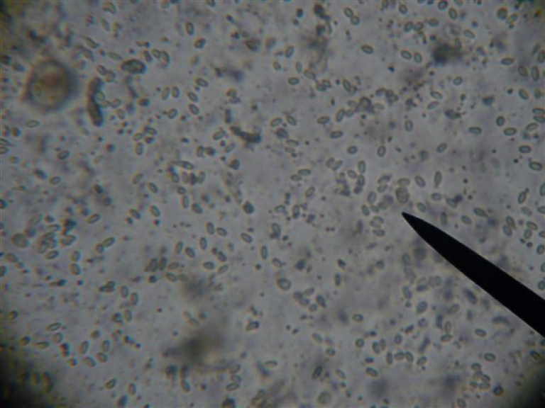 The "Nosema Twins" - Part 2 Detection & Microscopy - Scientific Beekeeping