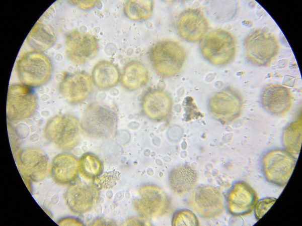 Sick Bees - Part 13: Simple Microscopy of Nosema for Beekeepers ...